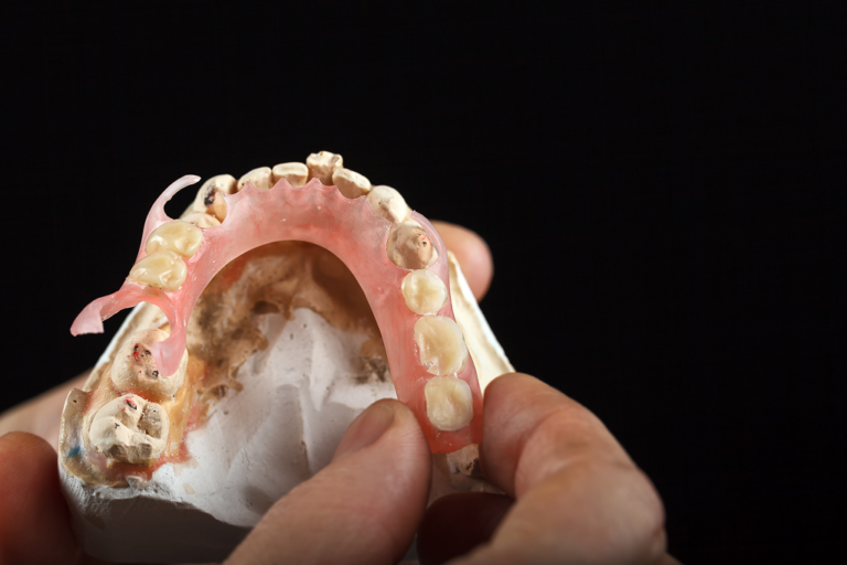 Denture Relining: Cost and Process | Greenwoods Dental