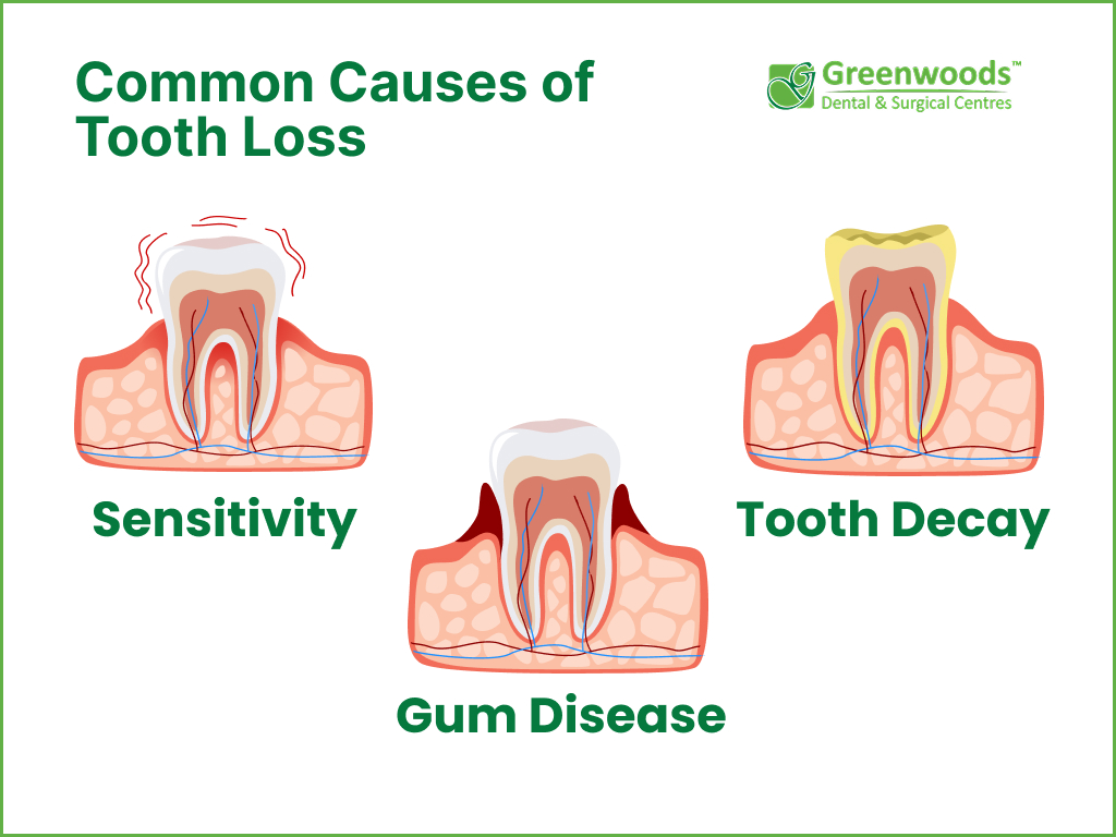 Missing Teeth? How Prosthodontic Services Help Transform Your Smile
